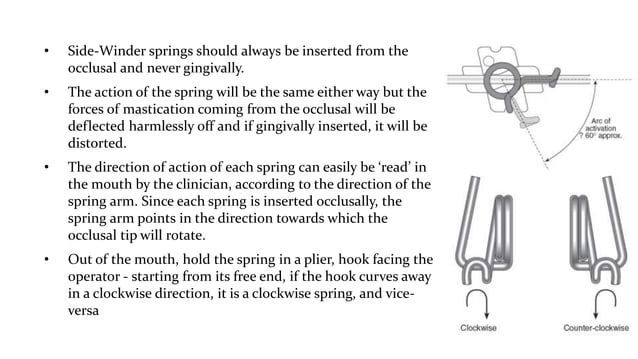 Tip edge mechanics | PPTX