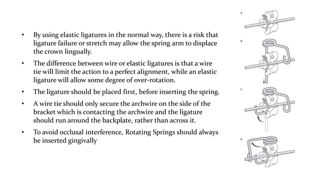 Tip edge mechanics | PPTX
