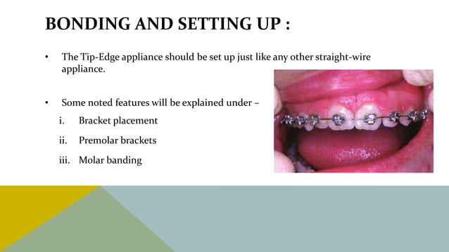 Tip edge mechanics | PPTX