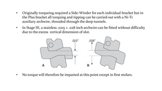 Tip edge mechanics | PPTX