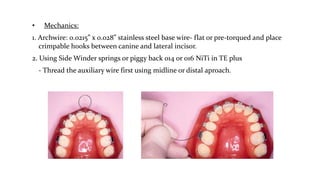 Tip edge mechanics | PPTX