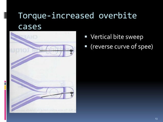 Tip edge orthodontics stage III | PDF