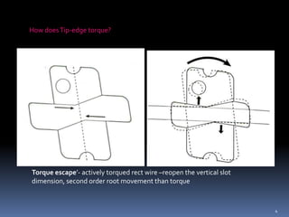 Tip edge orthodontics stage III | PDF