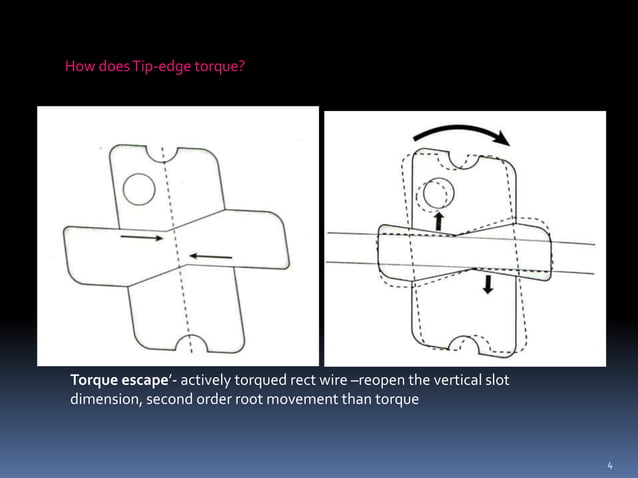 Tip edge orthodontics stage III | PDF