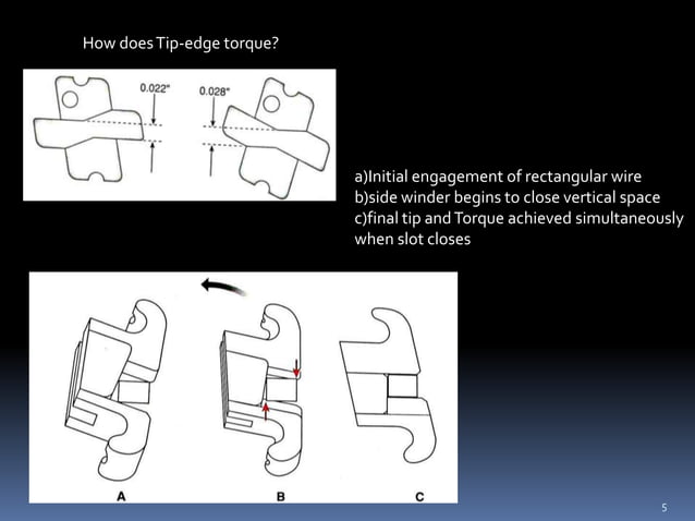 Tip edge orthodontics stage III | PDF