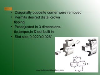 Tip edge technique | PPT