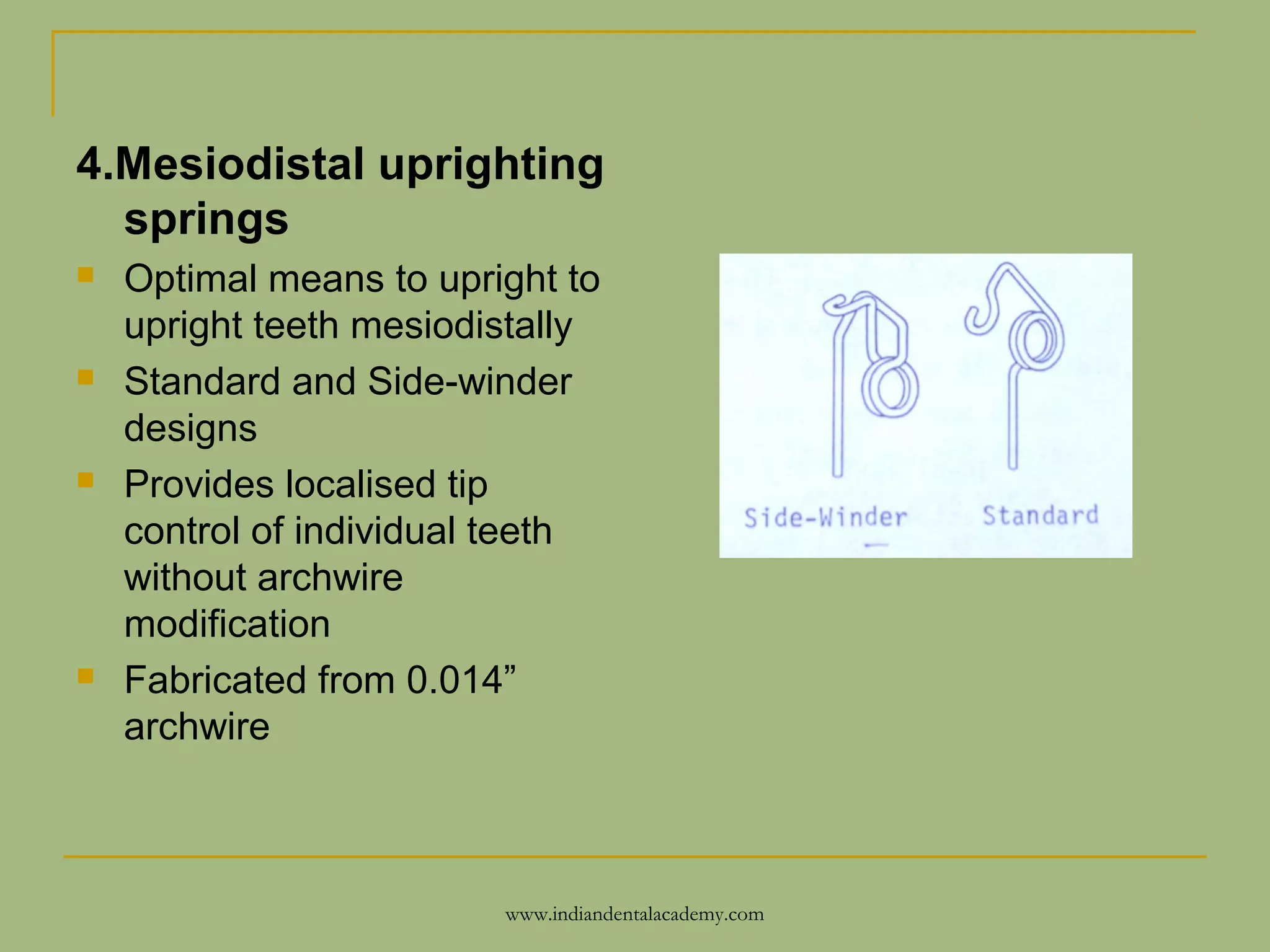 Tip edge technique final | PPT