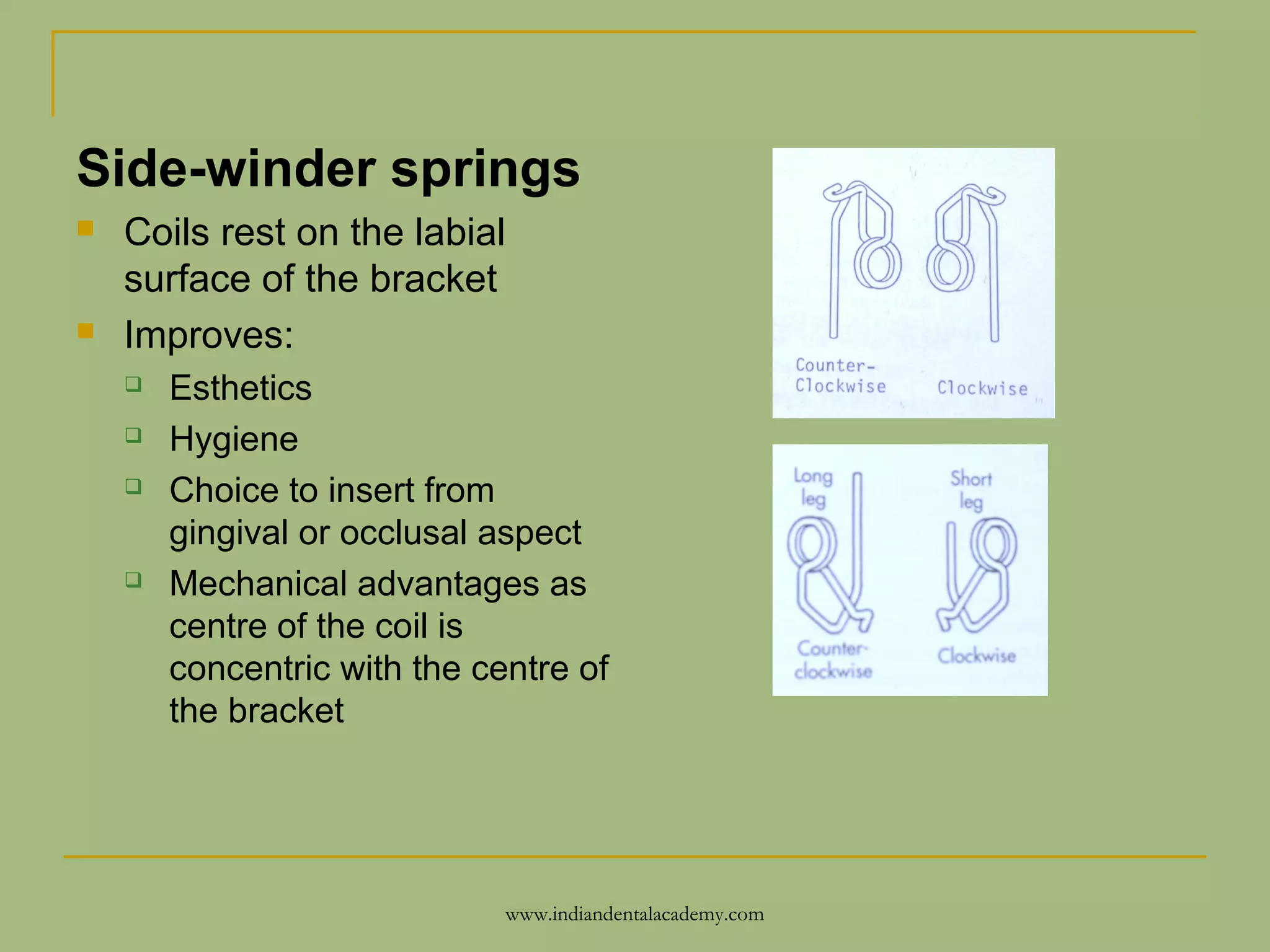 Tip edge technique final | PPT