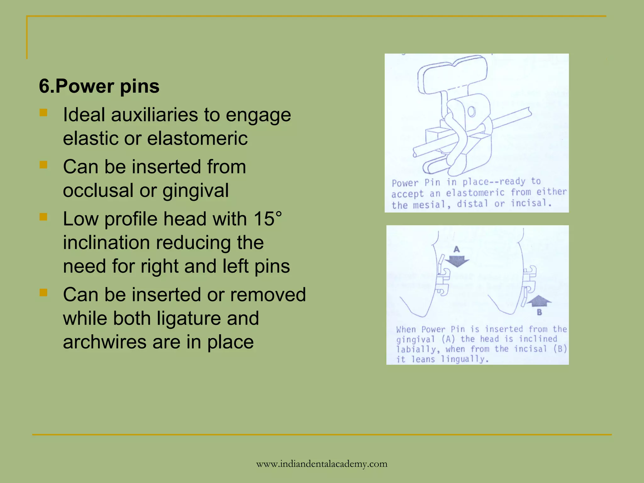 Tip edge technique final | PPT