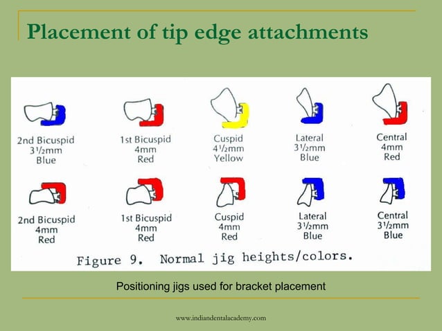 Tip edge technique final | PPT