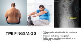 tipe PINGGANG DR NIA.pptx