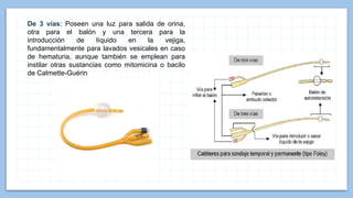 tipos-de-sondas-vesicales en el cuerpo h | PPTX