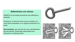 TIPOS DE ANCLAJES - Solange Solarte.pdf