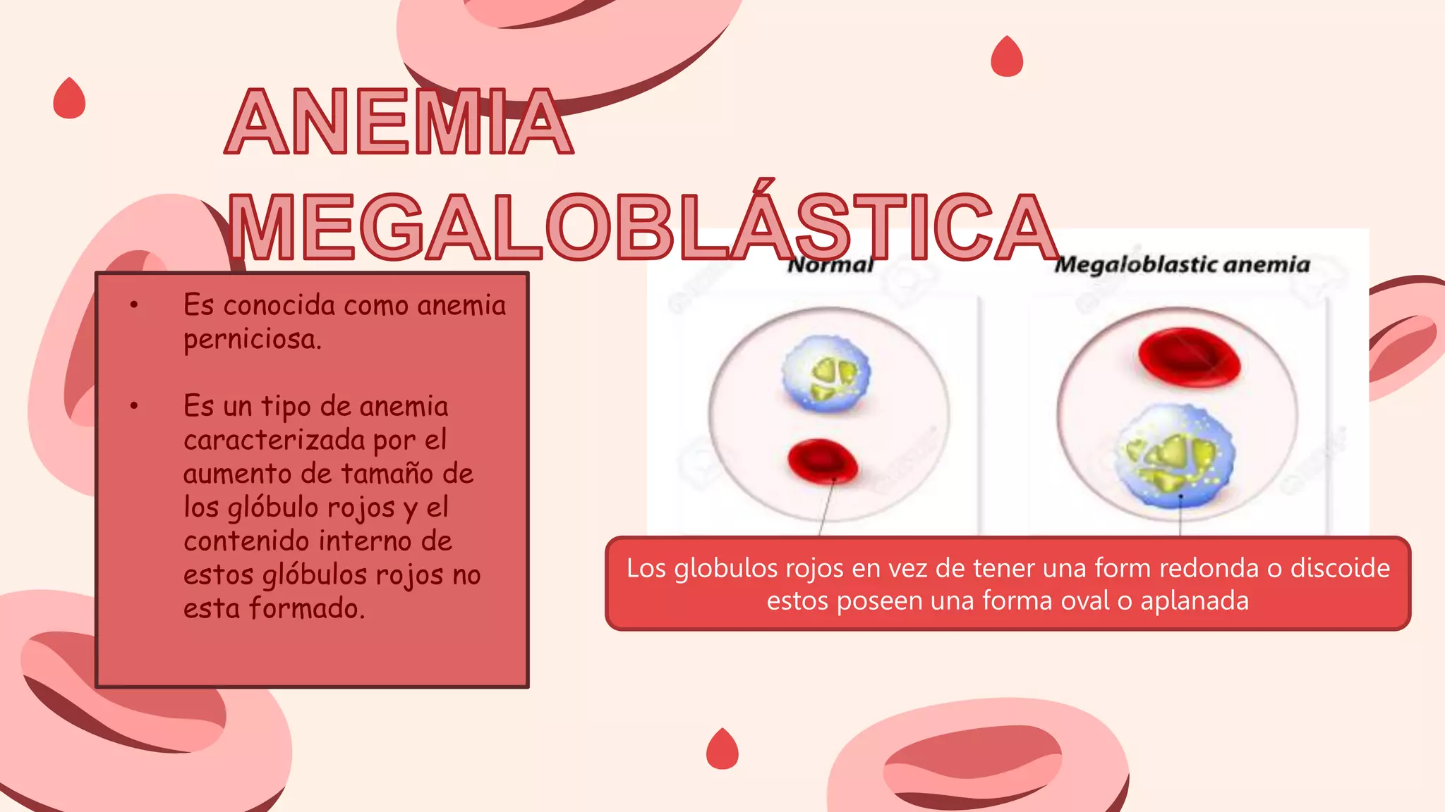 TIPOS DE ANEMIA N.pptx