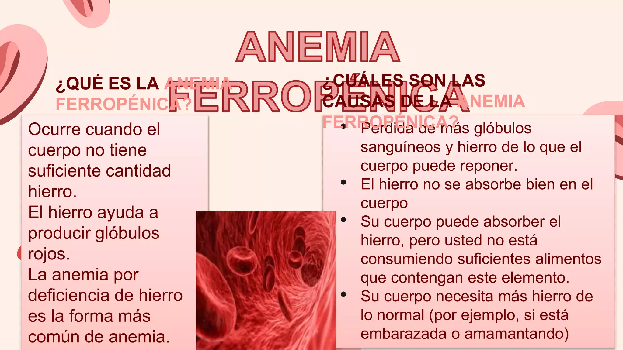 TIPOS DE ANEMIA N.pptx