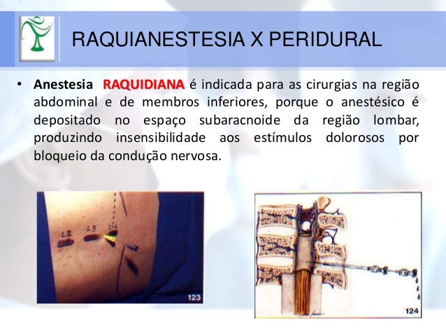 Anestesia Para Fazer Tattoos