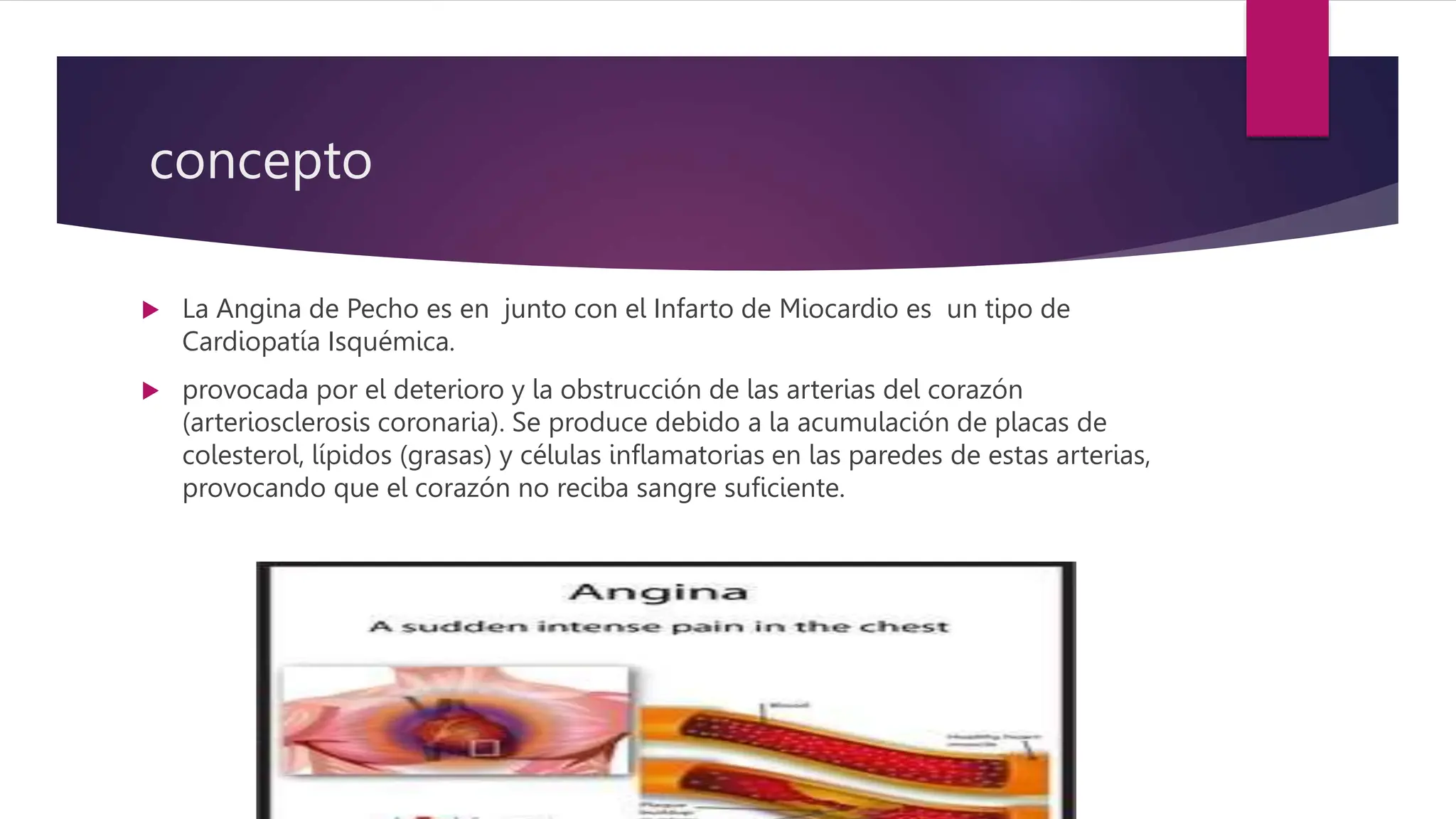 Tipos de angina, tipo de obstrucciones y.pptx