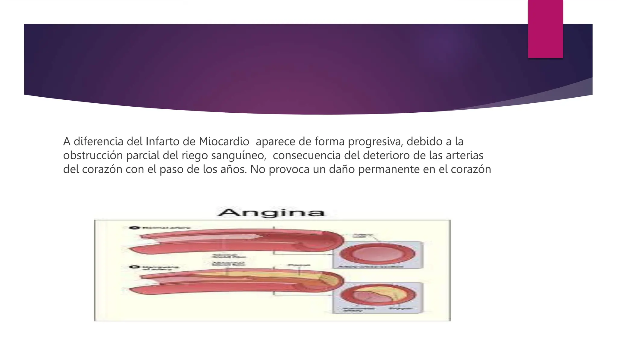 Tipos de angina, tipo de obstrucciones y.pptx