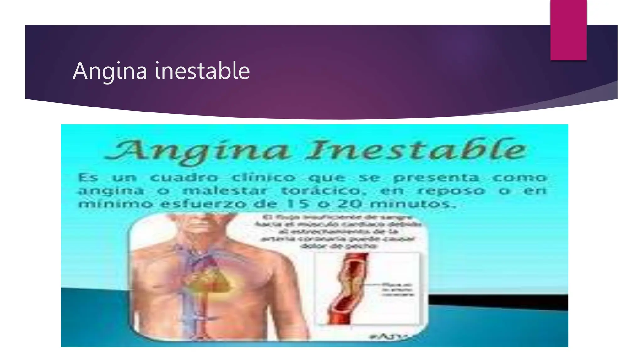 Tipos de angina, tipo de obstrucciones y.pptx