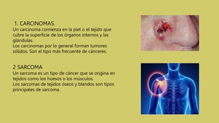 ¿Cuáles Son Las Similitudes Entre Los Diferentes Tipos De Cáncer? – IAHPB