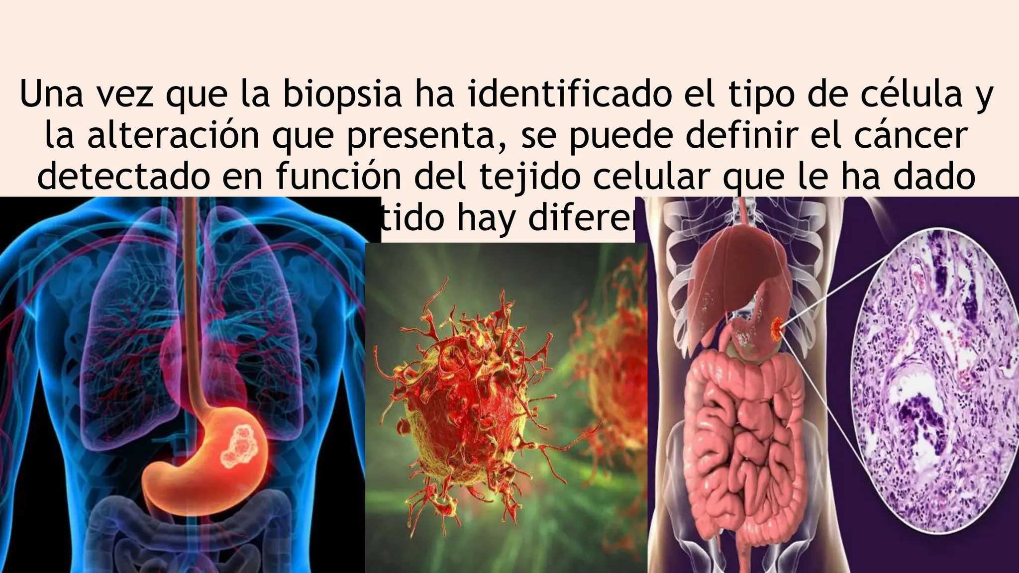 Tipos de cancer tipos de cancer en el cuerpo humano | PPTX