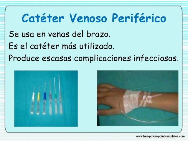 Tipos de cateter