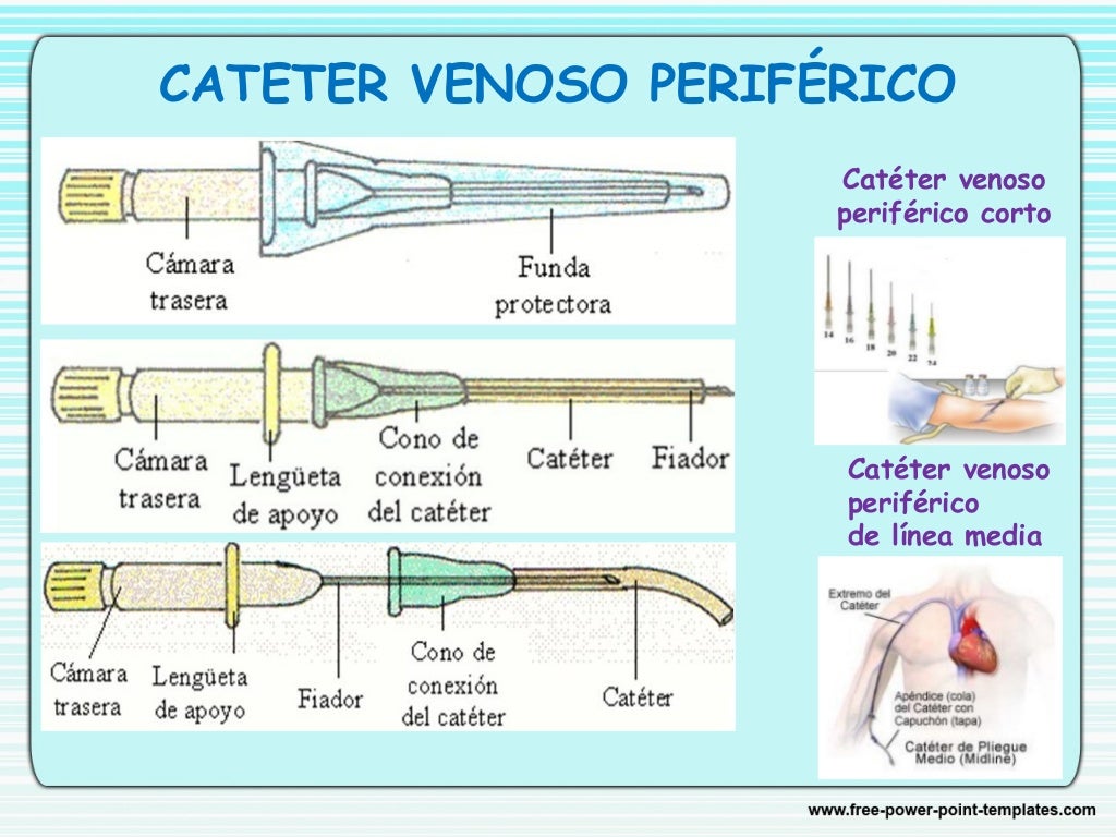 Tipos de cateter