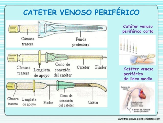 Tipos de cateter