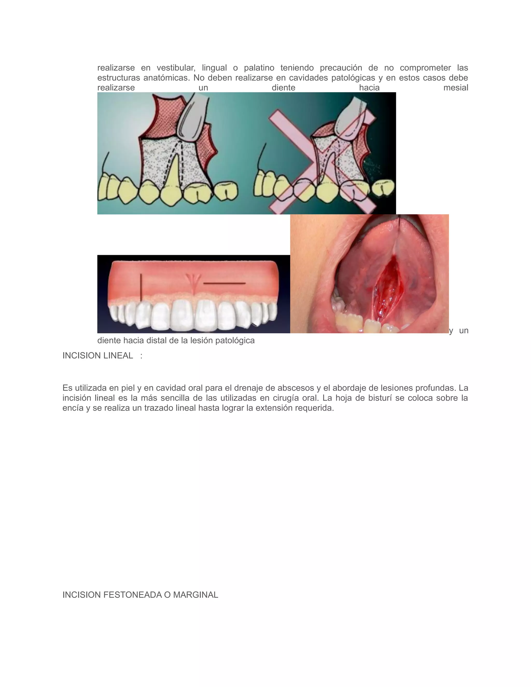 Tipos de colgajos en Odontologia- Dr Ricardo Cardozo.pdf