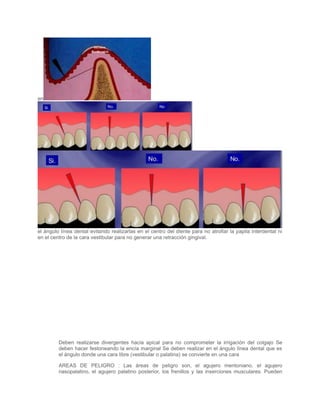 Tipos de colgajos en Odontologia- Dr Ricardo Cardozo.pdf