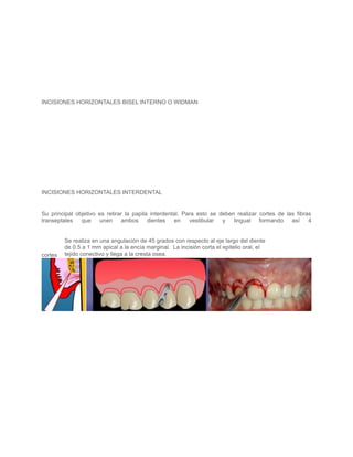 Tipos de colgajos en Odontologia- Dr Ricardo Cardozo.pdf