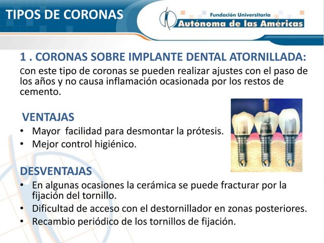 Tipos de coronas 3 | PPT