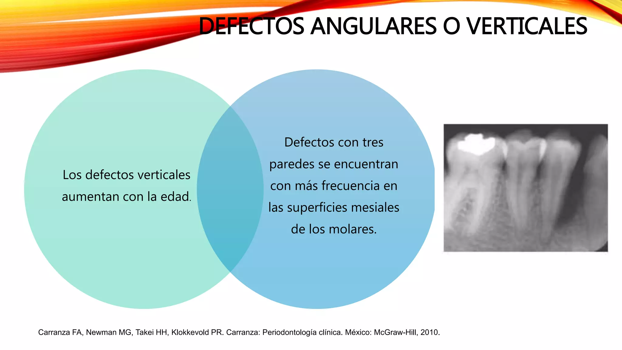 Tipos de defectos óseos, Cirugia resectiva de los tejidos blandos | PPTX