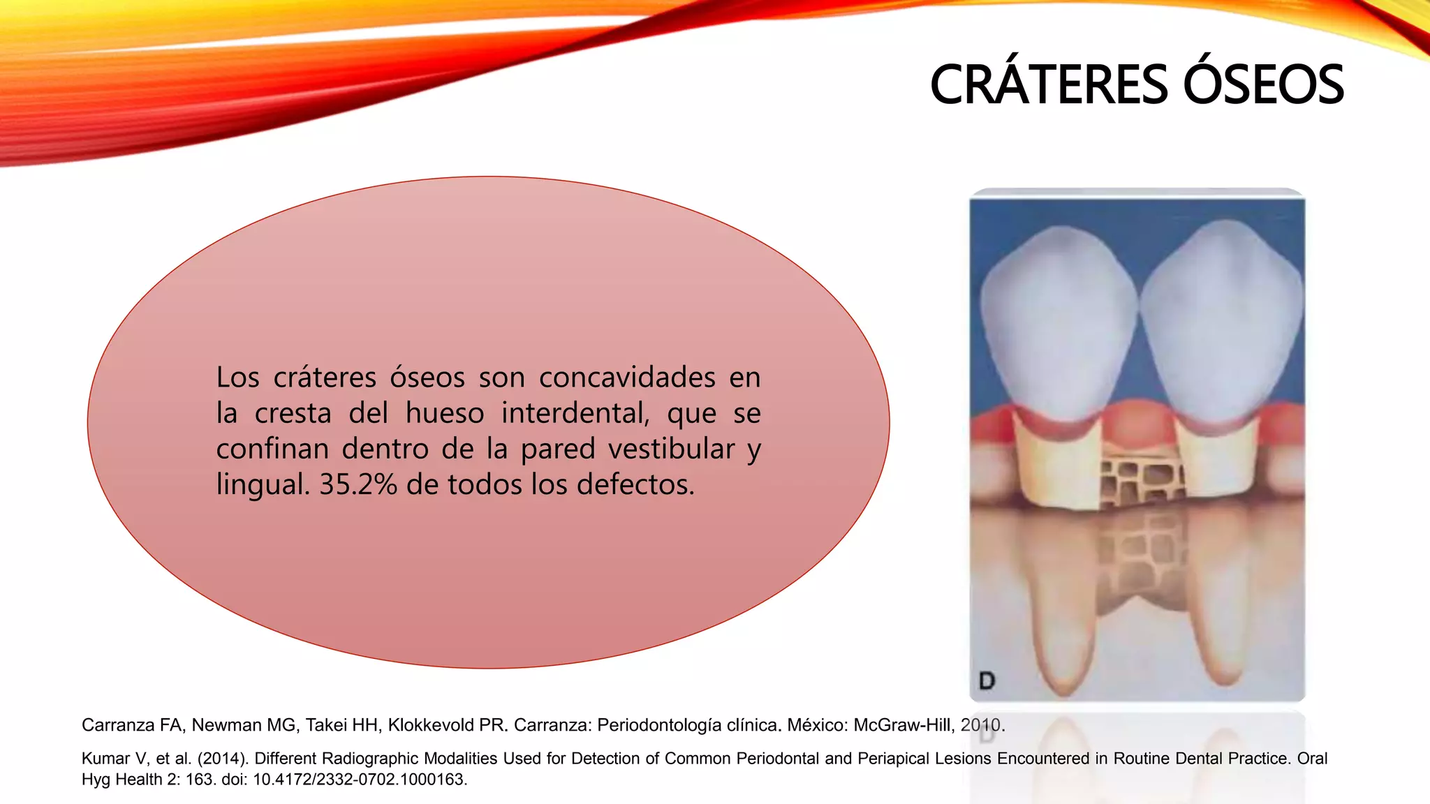 Tipos de defectos óseos, Cirugia resectiva de los tejidos blandos | PPTX