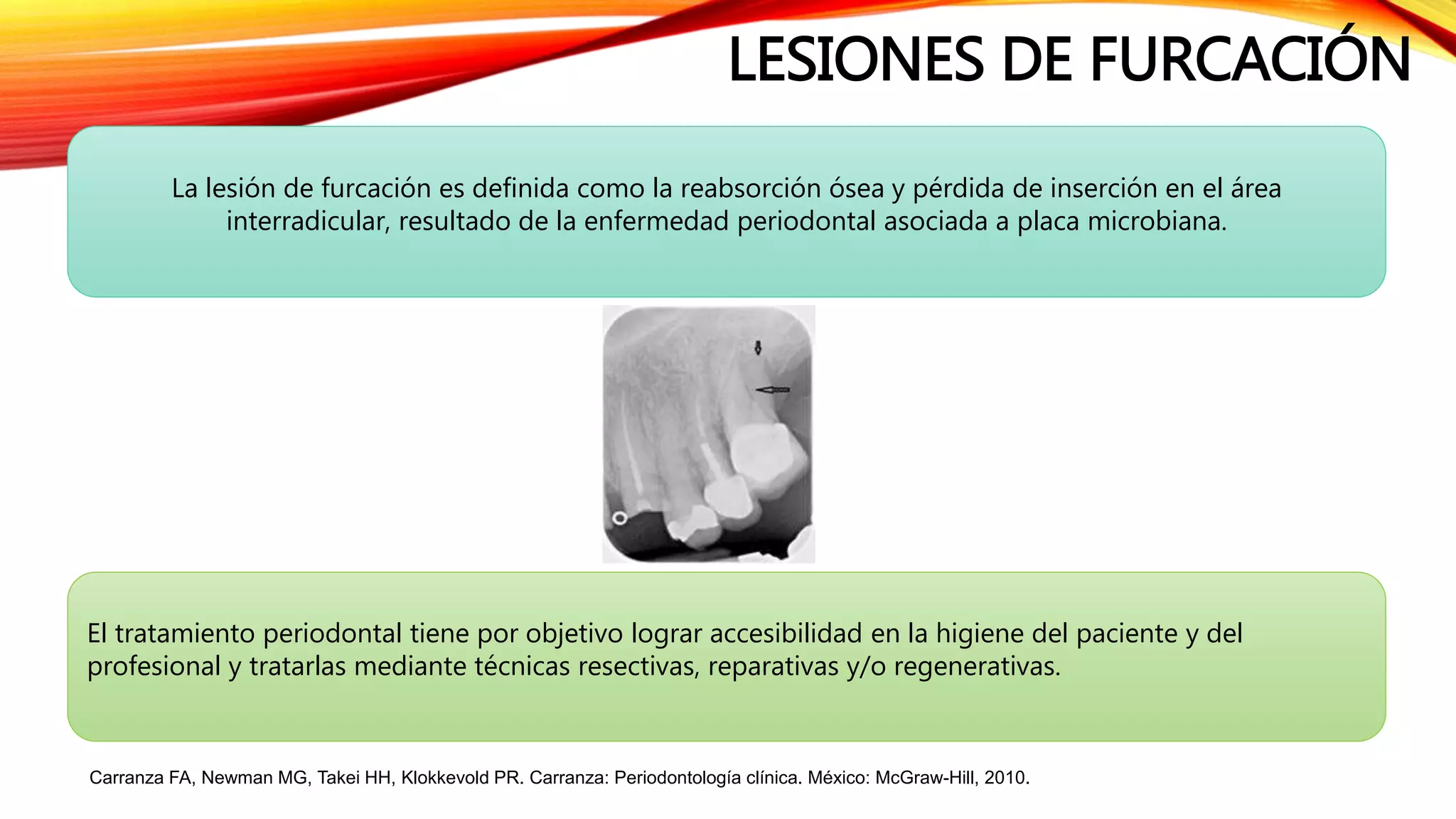 Tipos de defectos óseos, Cirugia resectiva de los tejidos blandos | PPTX