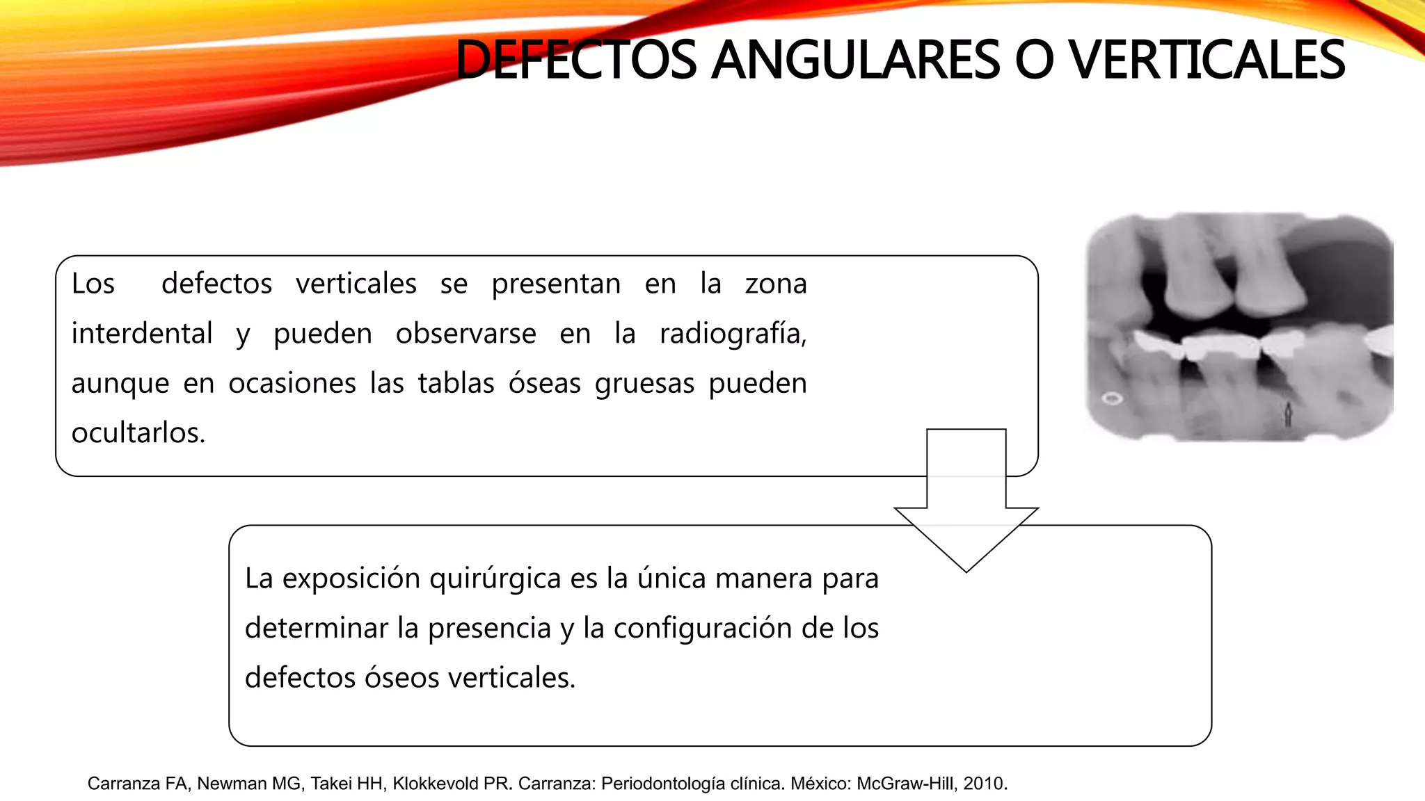 Tipos de defectos óseos, Cirugia resectiva de los tejidos blandos | PPTX