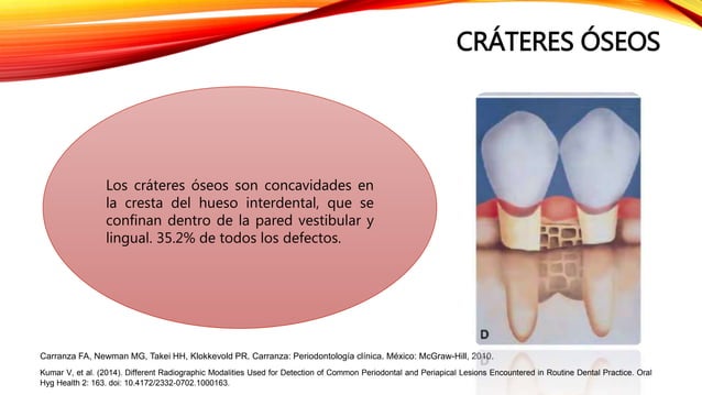 Tipos de defectos óseos, Cirugia resectiva de los tejidos blandos | PPTX