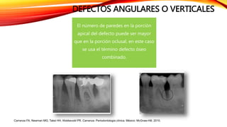 Tipos de defectos óseos, Cirugia resectiva de los tejidos blandos | PPTX