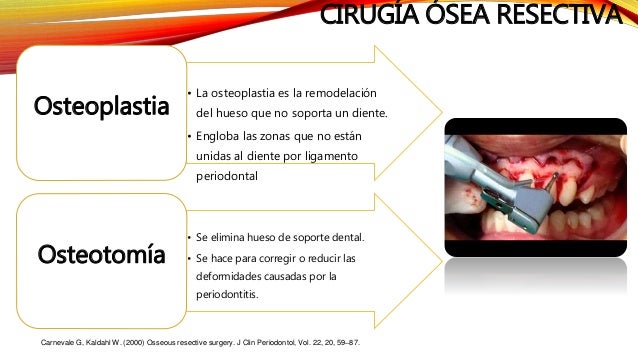 Tipos de defectos óseos, Cirugia resectiva de los tejidos blandos
