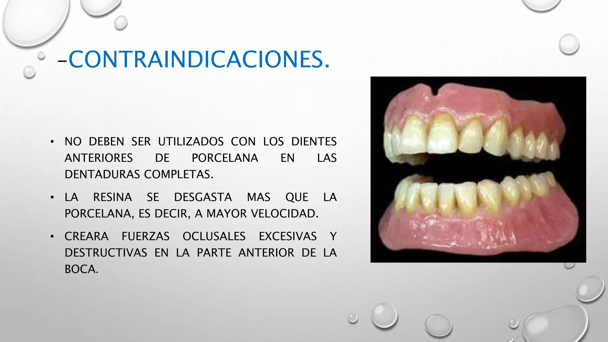 Tipos de dientes artificiales | PPTX