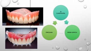 Tipos de dientes artificiales | PPTX