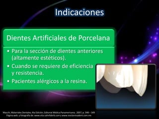Tipos de dientes artificiales | PPTX