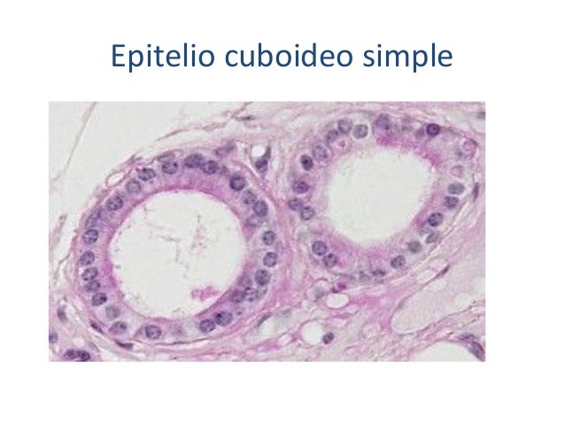 Tipos de epitelio