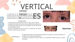 TIPOS DE ESTRABISMO Y SUS EJEMPLOS .pptx