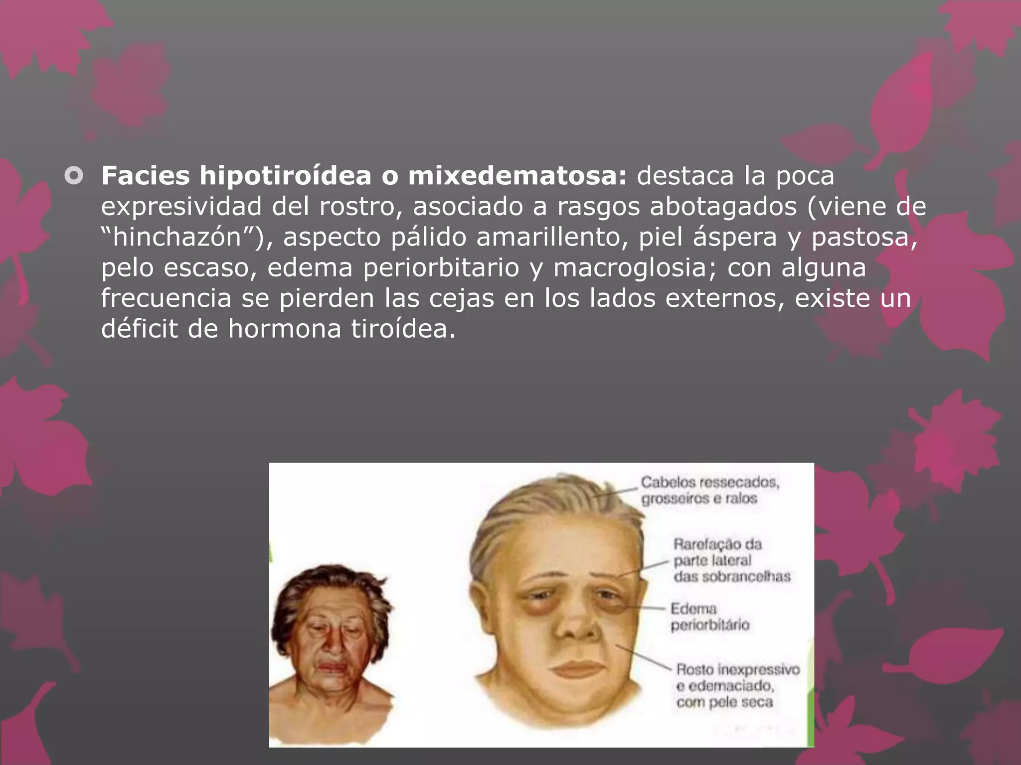 Tipos de facies | PPTX