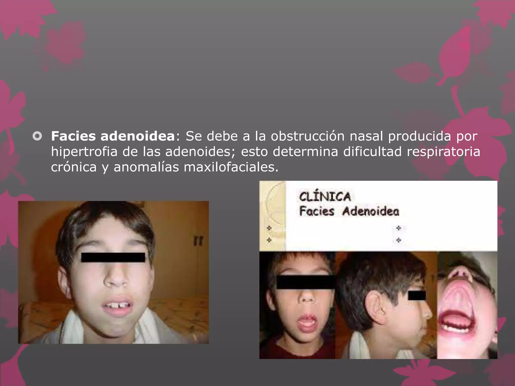 Tipos de facies | PPTX