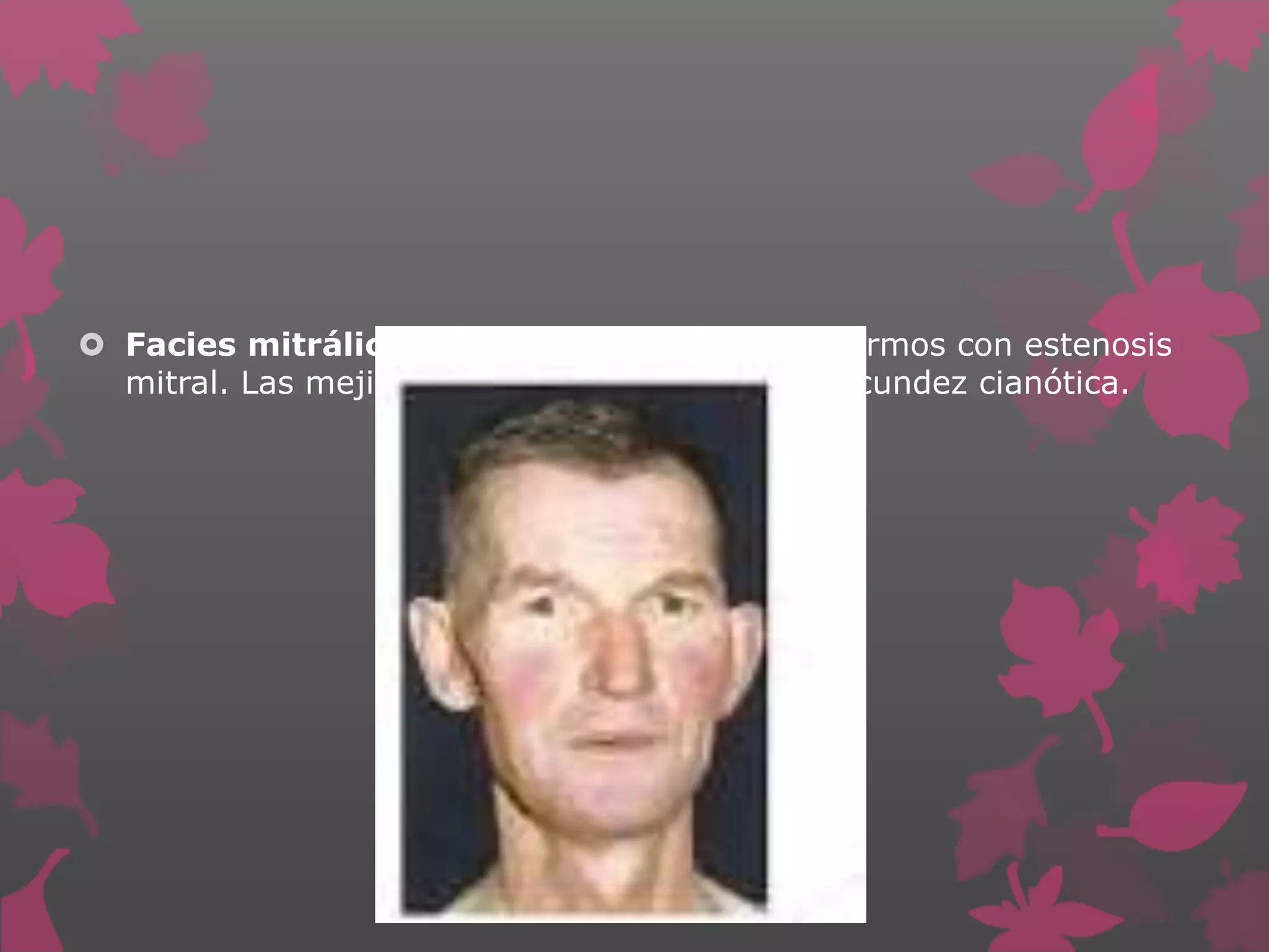 Tipos de facies | PPTX