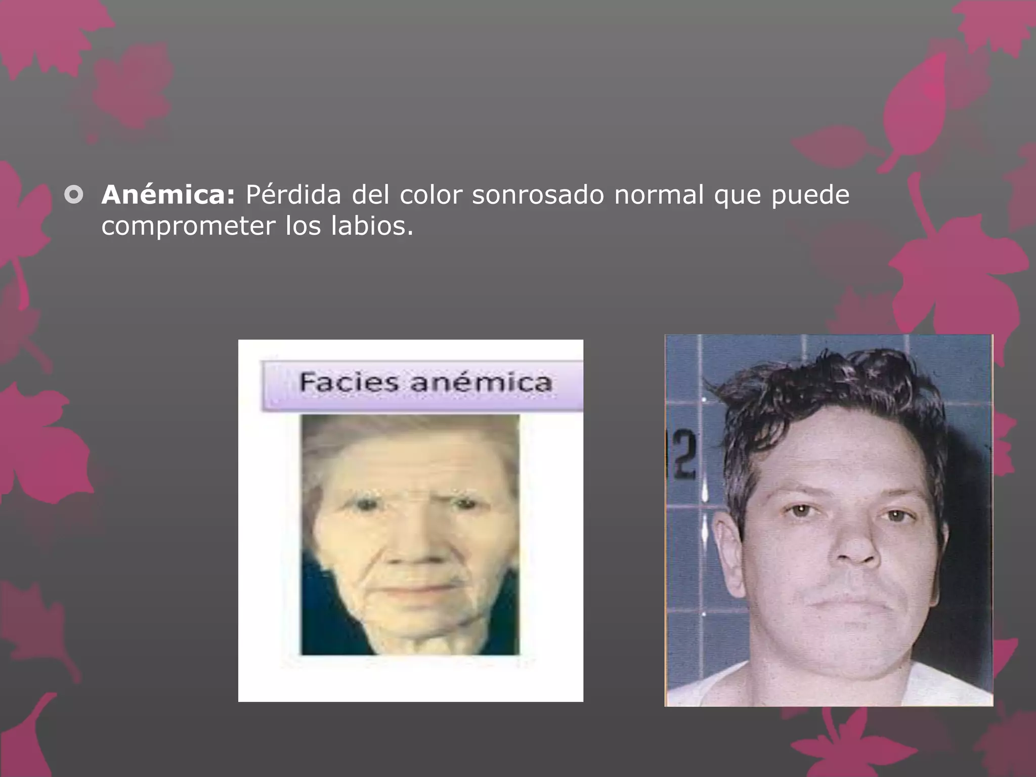 Tipos de facies | PPTX