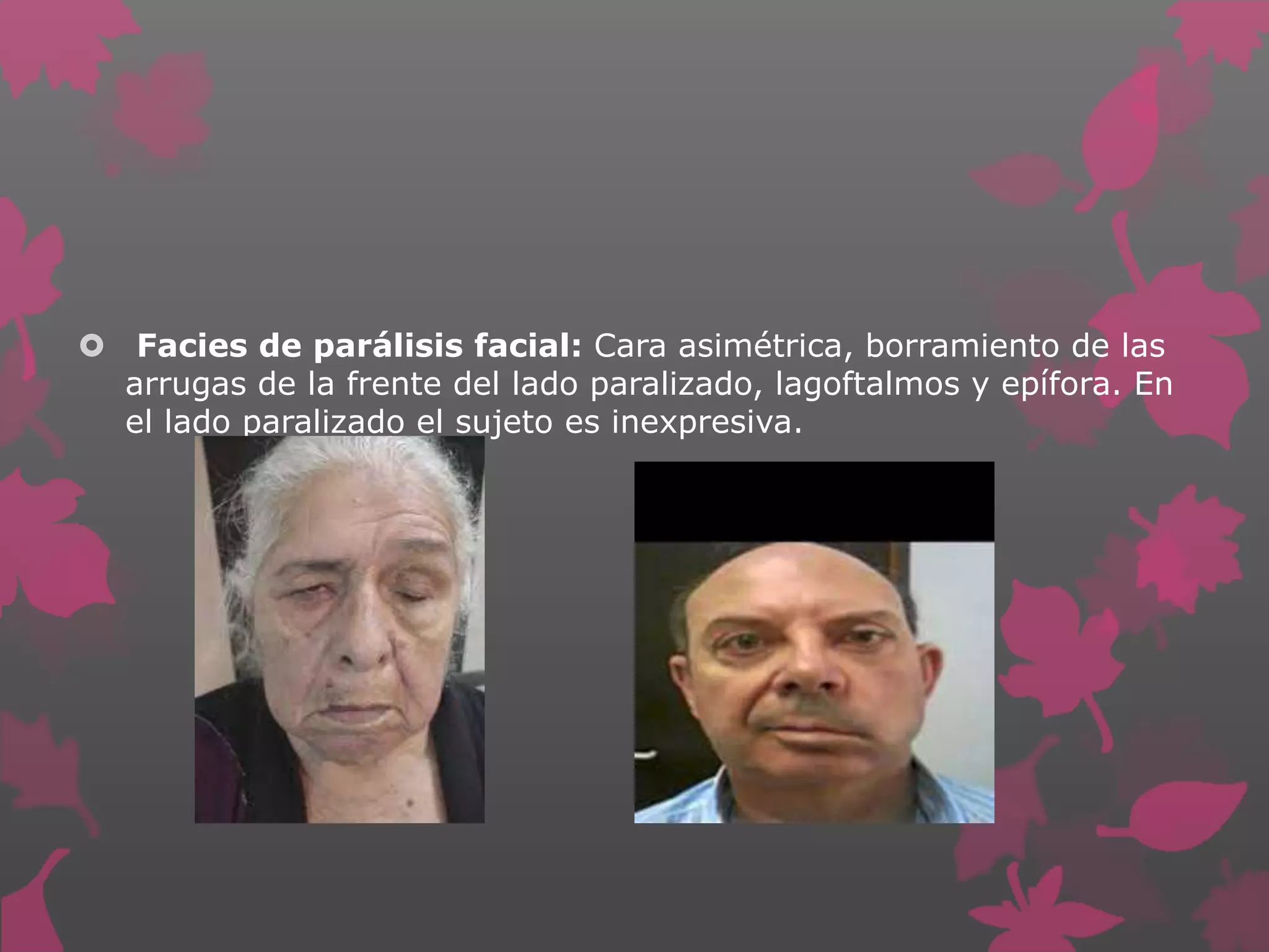 Tipos de facies | PPTX