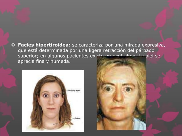 Tipos de facies | PPTX